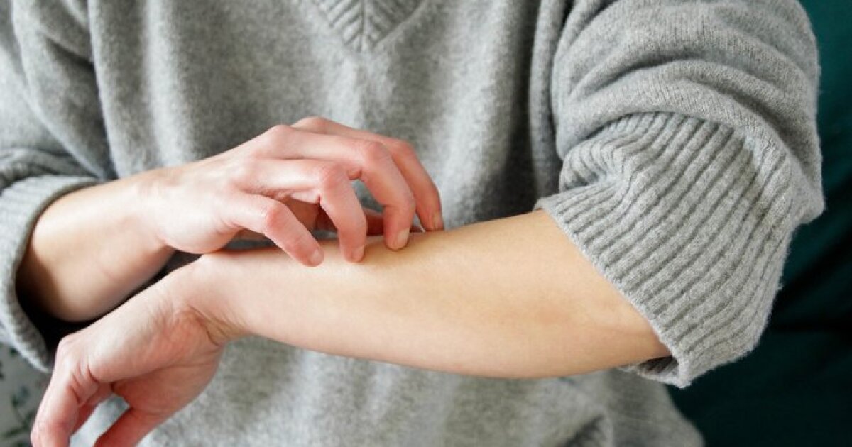 Аллергия на холод: почему возникает и как лечиться - Парламент.UA